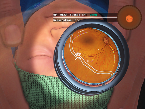 Eyesi Indirect ROP - Standardized curriculum